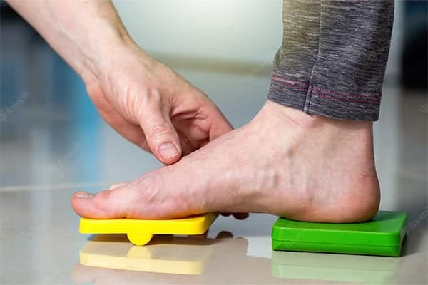 Pieds plats - Chirurgien orthopédique à Paris